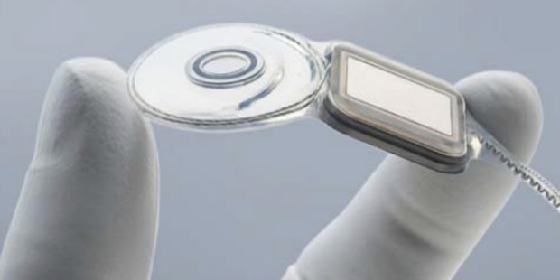 Cochlear adds remote monitoring to its hearing implants - Australian ...