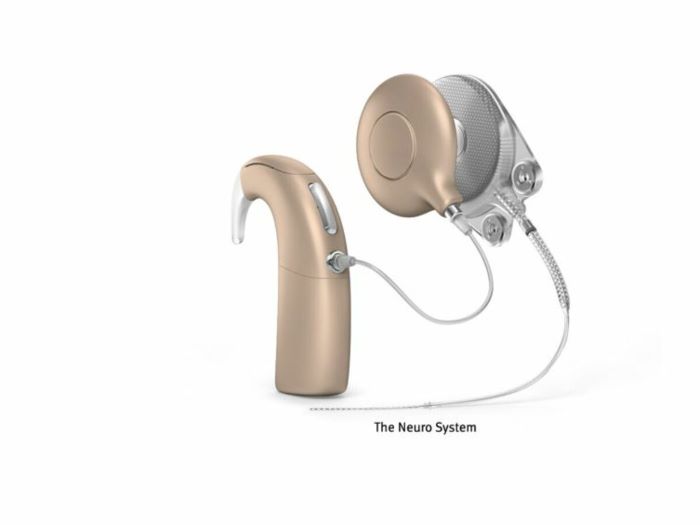 Cochlear gets UK clearance to take over competitor - Australian ...